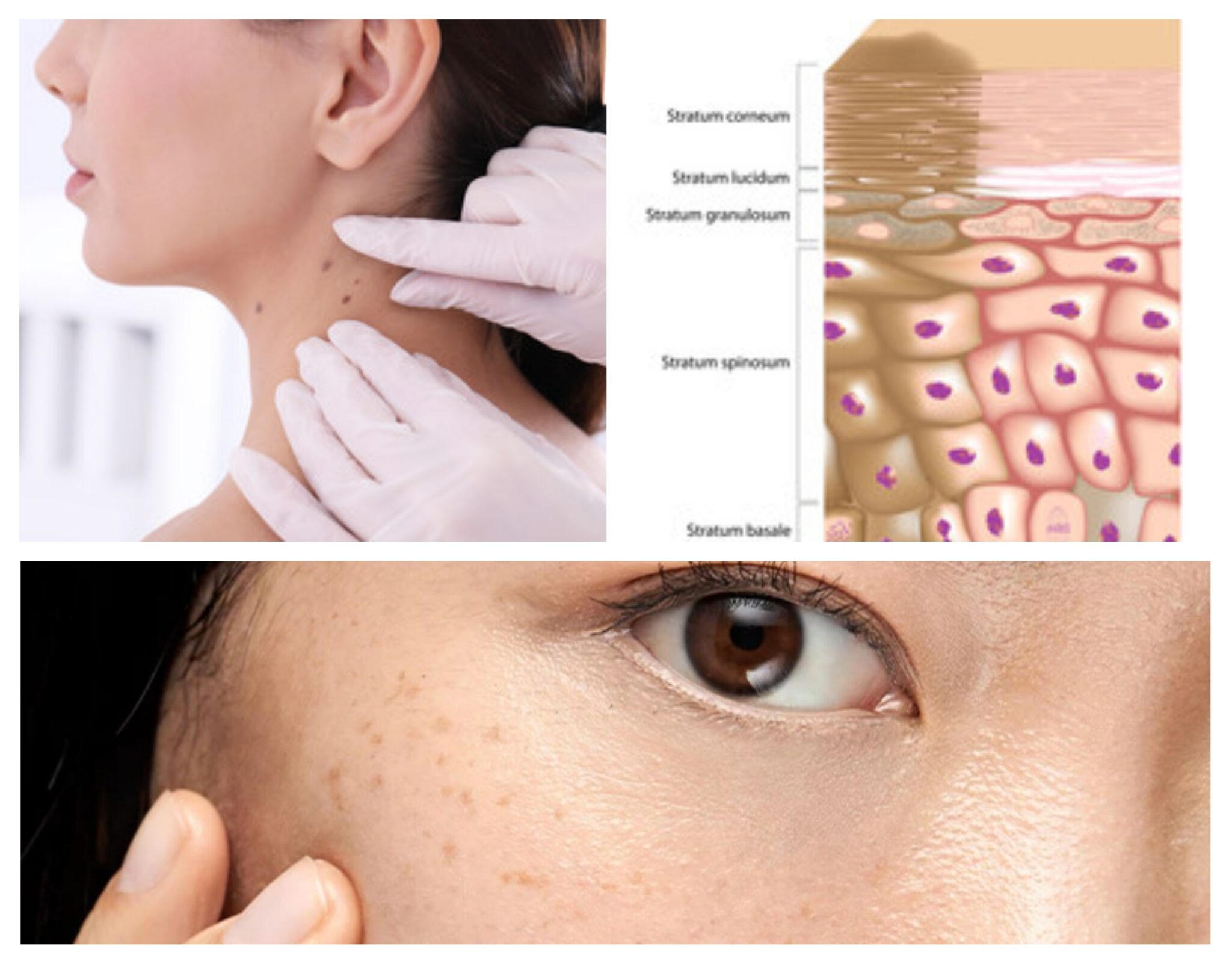 Empowering Beauty with Skin Pigmentation Solutions - Ethel Da Costa